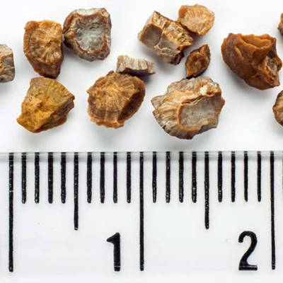 Ode to a Kidney Stone - Dr Michael Wald, Blood Detective